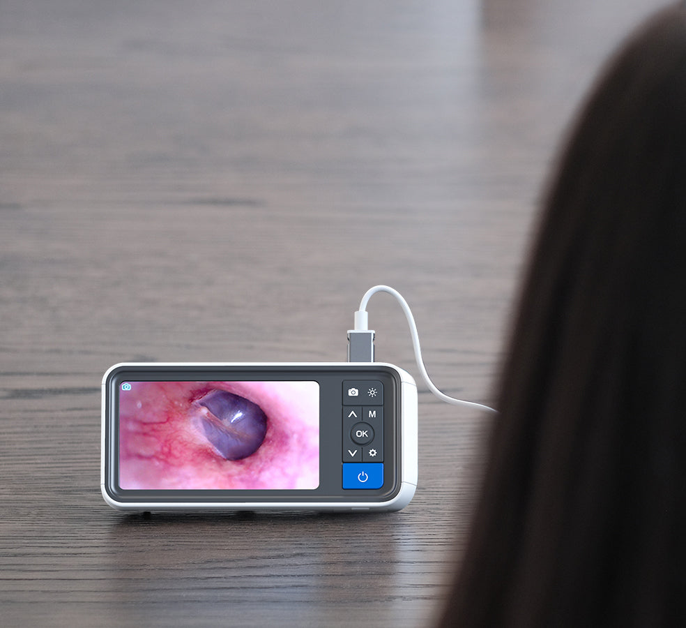 iPhone Otoscope for Ear Exams | Teslong Apple-Compatible Ear Camera
